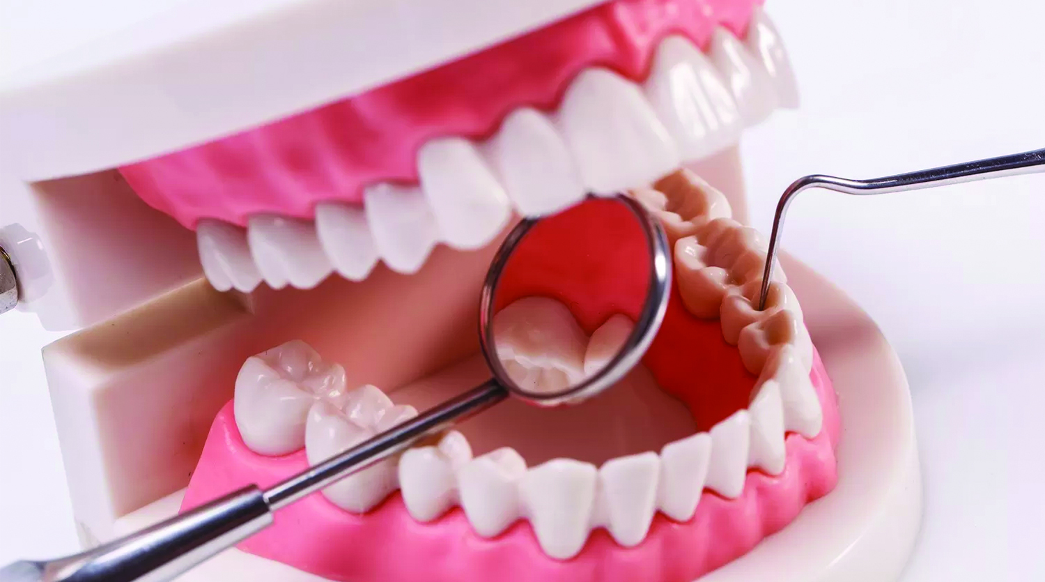 Functional Appliances - CXC Dental